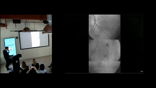 Пигментные изменения на глазном дне: всё видно, ничего не понятно