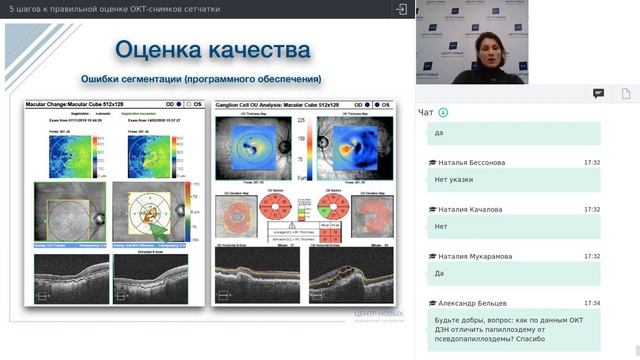 Вебинар по оценке ОКТ-снимков сетчатки. Панфилова А.Н.