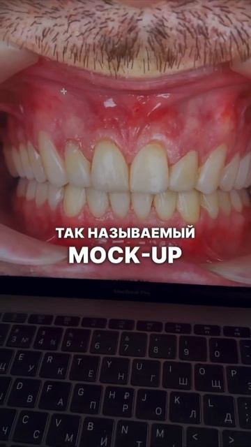 Стоматологическая клиника в Москве | м. Университет | Shifa  #стоматологиямосква