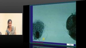 NEETPG Coaching Gyn Obs Topic 05 bacterial vaginosis by Dr.Shilpa