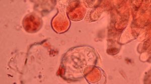 Conidias de Entomophthorales 1-3