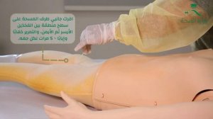 Candida Auris Screening Procedure