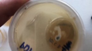Breeding Project day 11 update: Haploid Isolates are growing!