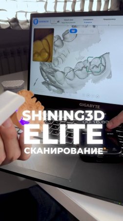 🔴 Скорость сканирования SHINING3D Aoralscan Elite