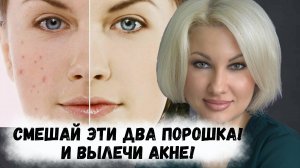 Смешай эти два порошка и вылечи акне! #красота #любовь #женщина #женщины #лучшее #здоровье #жизнь