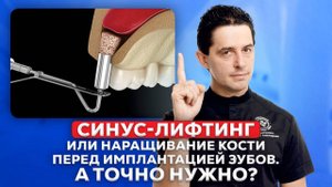 Синус-лифтинг_ Как вернуть красивую улыбку!