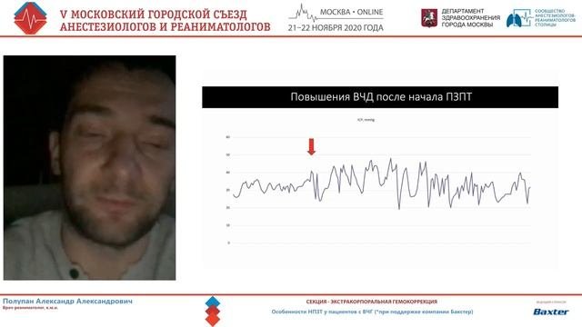 ЗПТ при ВЧГ Полупан АА 2020