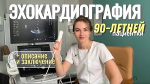 ЭхоКГ 90 летней женщины. Измерения, описание и заключение