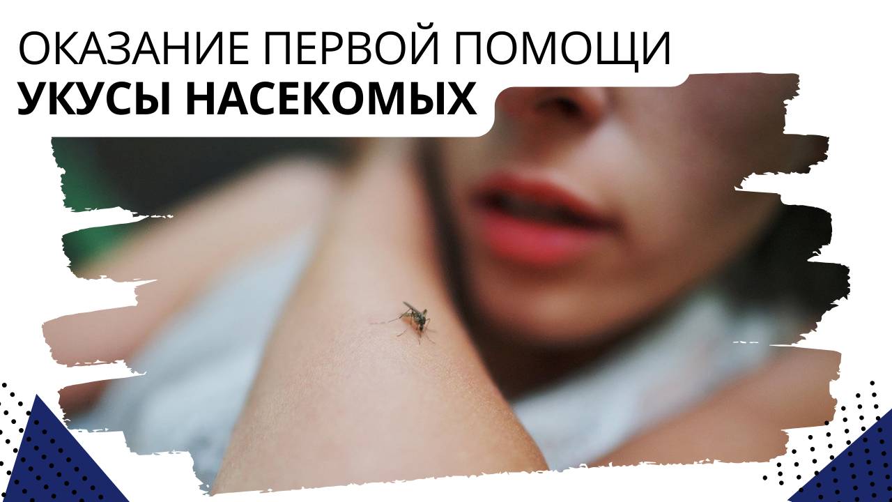 Оказание первой помощи. Укусы насекомых