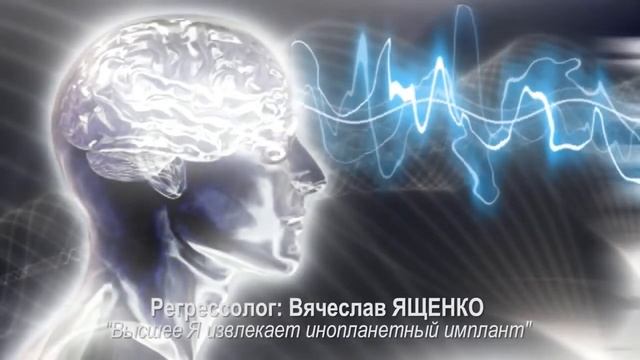 сеанс регрессии ВЫСШЕЕ Я ИЗВЛЕКАЕТ ИНОПЛАНЕТНЫЙ ИМПЛАНТ