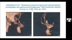 Капто А.А. Стандартизация проведения МСКТ кавернозографии в холдинге СМ-Клиника. 22.02.2024.