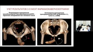 Капто А.А. Транслюминальная пенильная веноабляция по Bookstein J.J., Lurie A.L. 07.03.2024.