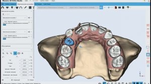 Maestro 3D. Новая 6-я версия │Стоматологическая клиника "Ортодонт", г. Самара