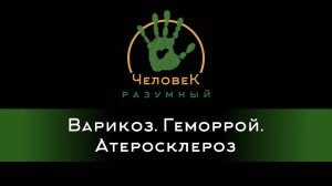 Варикоз. Геморрой. Атеросклероз (Скудов Алексей Юрьевич, 2018)