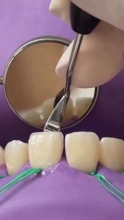 Free Hand Diastema Closure ⚡ #viral #shorts