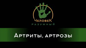 Артриты, артрозы (Скудов Алексей Юрьевич, 2018)