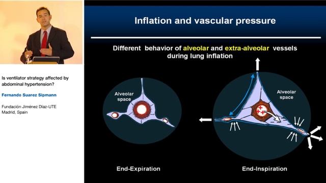 Impact of circulation on ALI and ARDS. F S Sipman 2005 Strasb