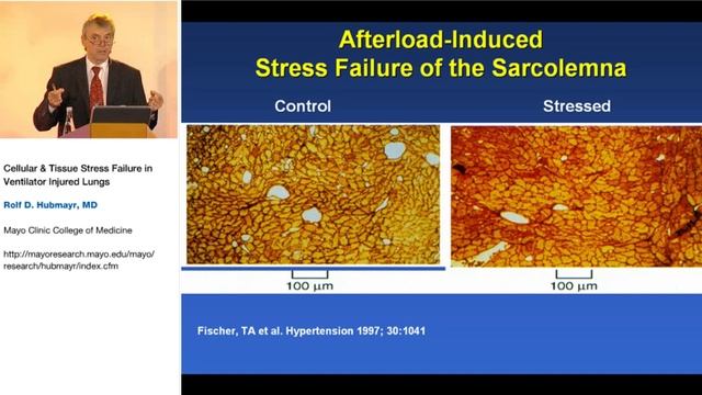 Cellular & Tissue StressFailure in VILI Rolf D Hubmayr 2005 Strasb