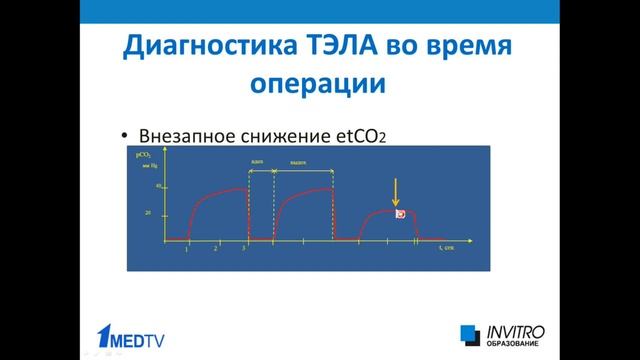 Профилактика тромбоэмболии легочной артерии Красносельский М Я