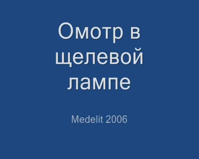 Осмотр в щелевой лампе