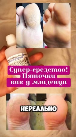 "Трещины и сухость на пятках? Скажи «прощай» с этим средством!" https://t.me/+bwsrVD_36g1iY2Iy