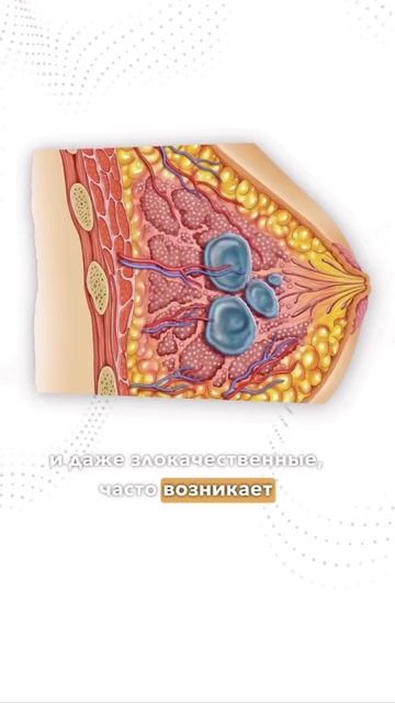 Вред бюстгальтера 🤫