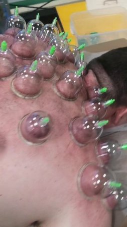 ударно-динамический массаж Нижний Новгород Нижегородский Костоправ 89870878785