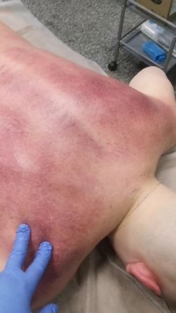 Готовим к правке Нижегородский Костоправ Нижний Новгород 89870878785