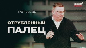 Отрубленный палец | Денис Малютин | Церковь "Неемия" г. Омск