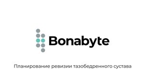 Планирование ревизии тазобедренного сустава