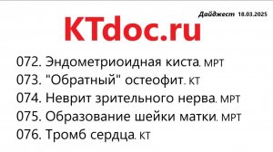 Дайджест 18.03.2025