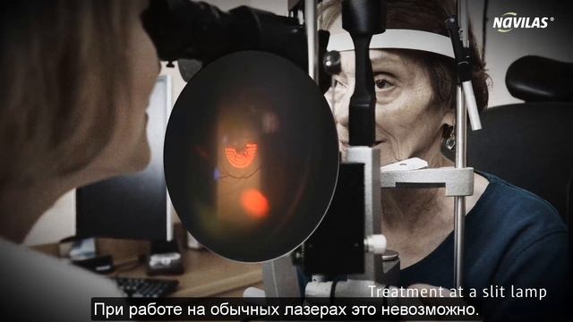 Лазерное бесконтактное лечение сетчатки Navilas в Офтальмологической клинике Спектр (Москва).