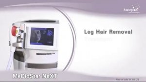 Лазерная_эпиляция_на_лазере__MeDioStar_NeXT__с_александритовой_насадкой
