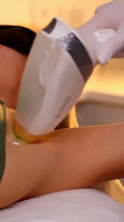 FLUID_CLINIC_Процедура_эпиляции_на_двухволновом_лазере_ASCLEPION