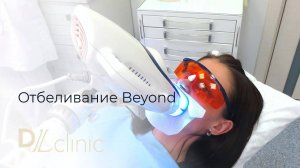 Отбеливание зубов системой BEYOND в DLclinic