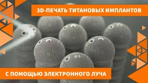 3D-печать титановых имплантов с помощью электронного луча