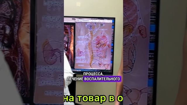 Комплексный подход к лечению боли в спине- от регуляции микрофлоры до висцеральной и остеопатической