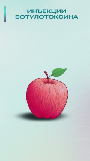 Инструкция Ботулотоксин
