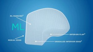 Dextile™ anatomical mesh