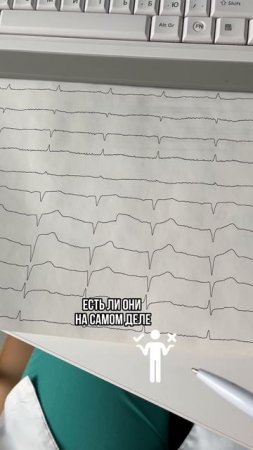 Случился ИНФАРКТ!