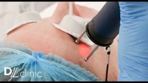Фракционное лазерное омоложение кожи в DLclinic