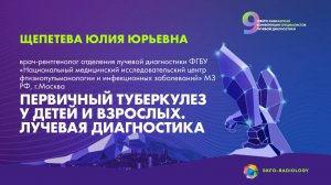Первичный туберкулез у детей и взрослых. Лучевая диагностика - Щепетева Юлия Юрьевна