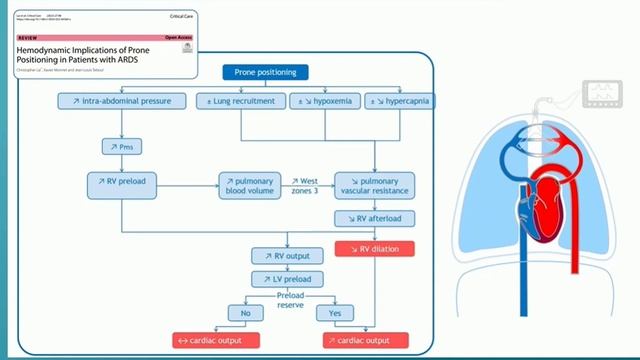 PRONE POSITION Hemodynamic effects  Xavier Monnet ISICEM-44 (2025)