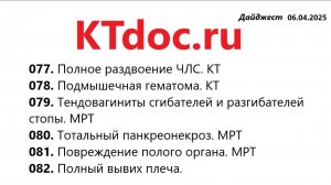 Дайджест 06.04.2025