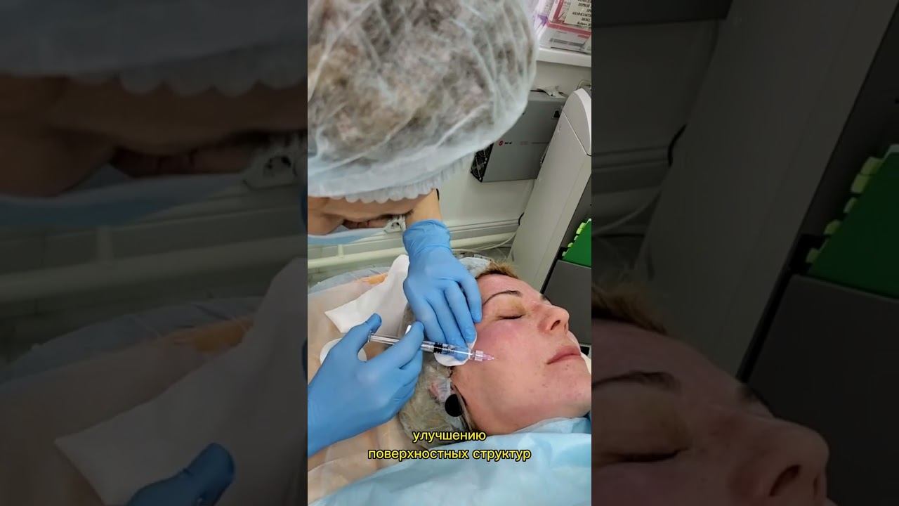 Биоревитализация Plinest