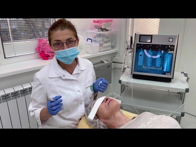 Belotero Soft в технике «blanching»