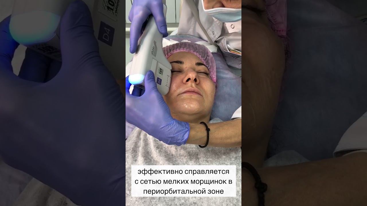 Аппарат Doublo HIFU