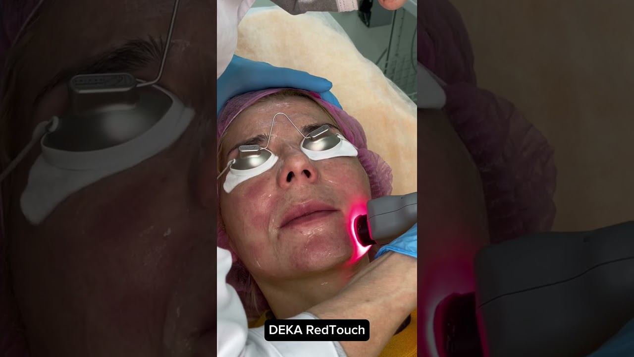 Процедура RedTouch