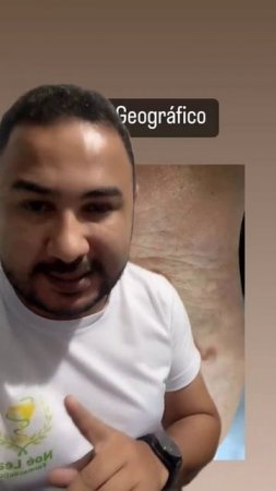 Bicho geográfico, acabe com esse parasita!