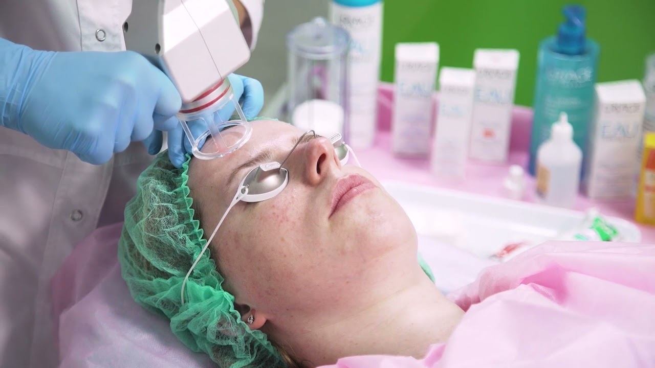 Фракционное омоложение на аппарате Космопульс II